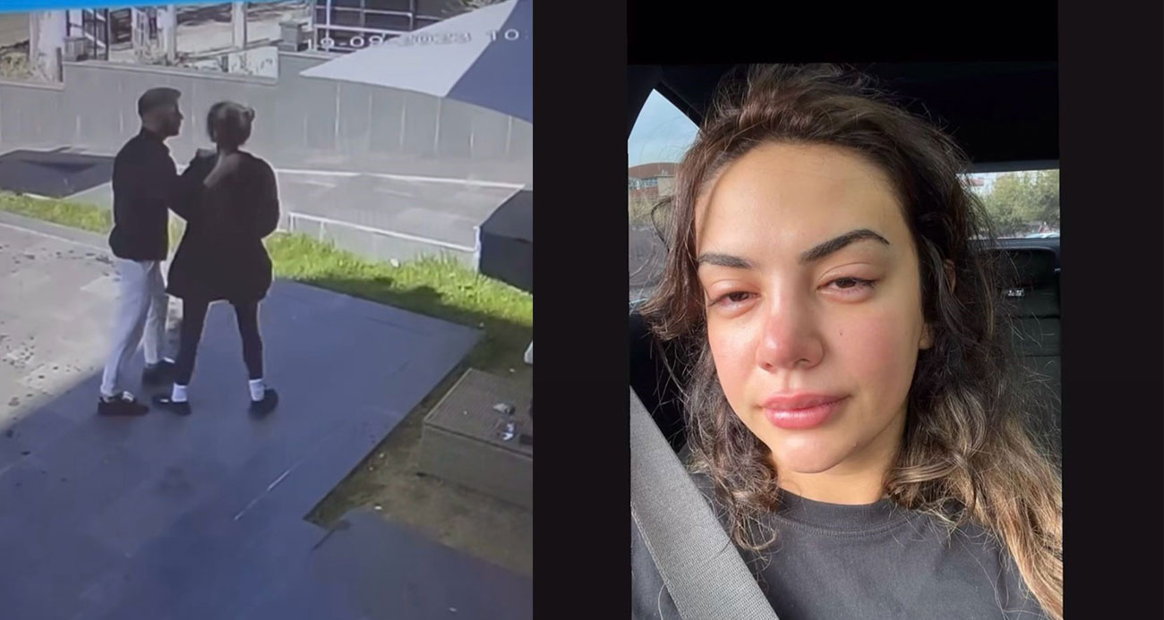 Ece Ronay’a eski eşinden şiddet İhlas Haber Ajansı