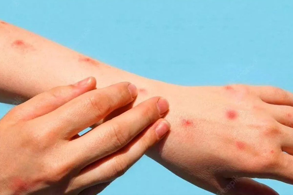 'Domates gribinin kontrol altına alınması zor görünüyor' İhlas Haber Ajansı